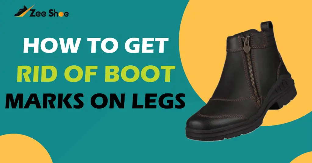 How To Get Rid Of Boot Marks On Legs? Complete Guide | 2025